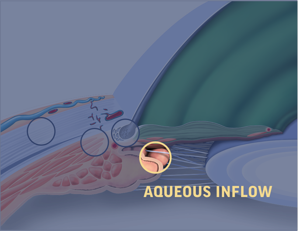 Glaucoma Pipeline 2026 - Glaucoma Today