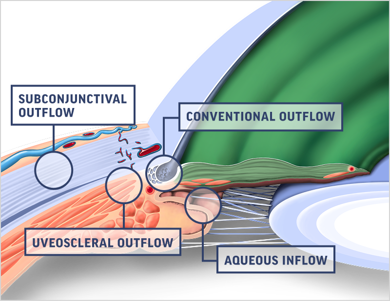 Glaucoma Pipeline 2026 - Glaucoma Today